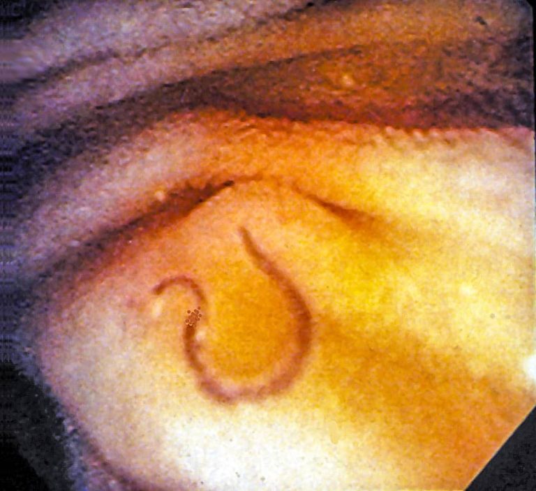 Intestinal Nematodes | Parasites without Borders