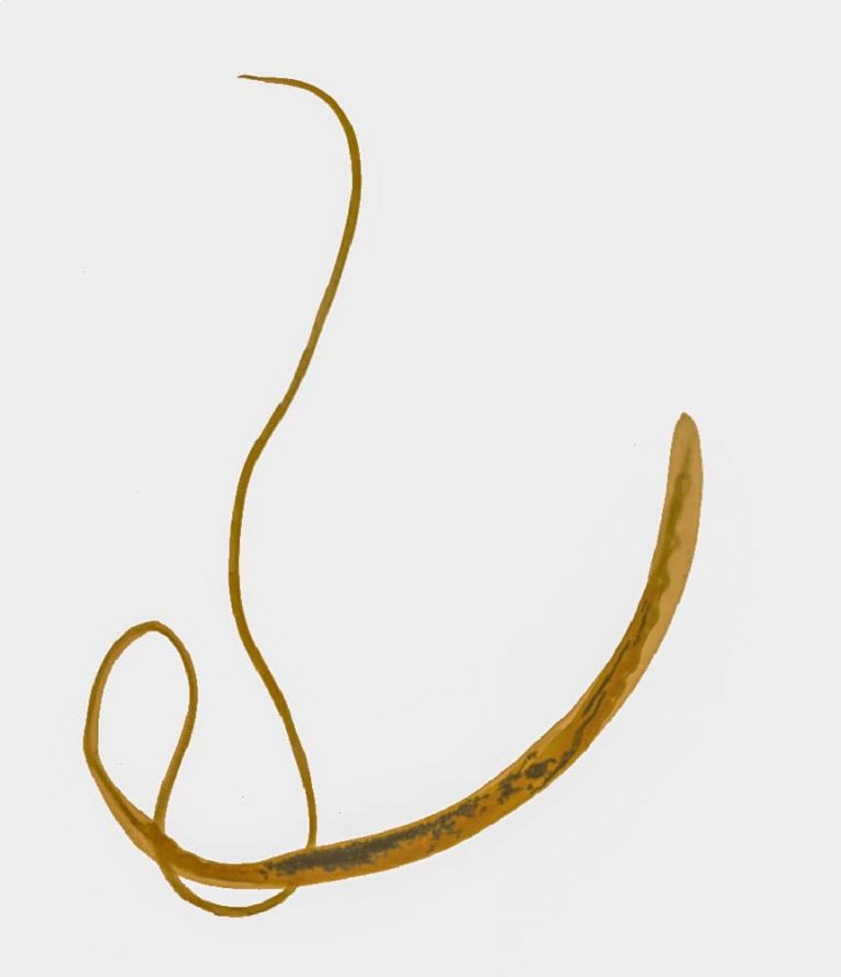 Intestinal Nematodes | Parasites without Borders