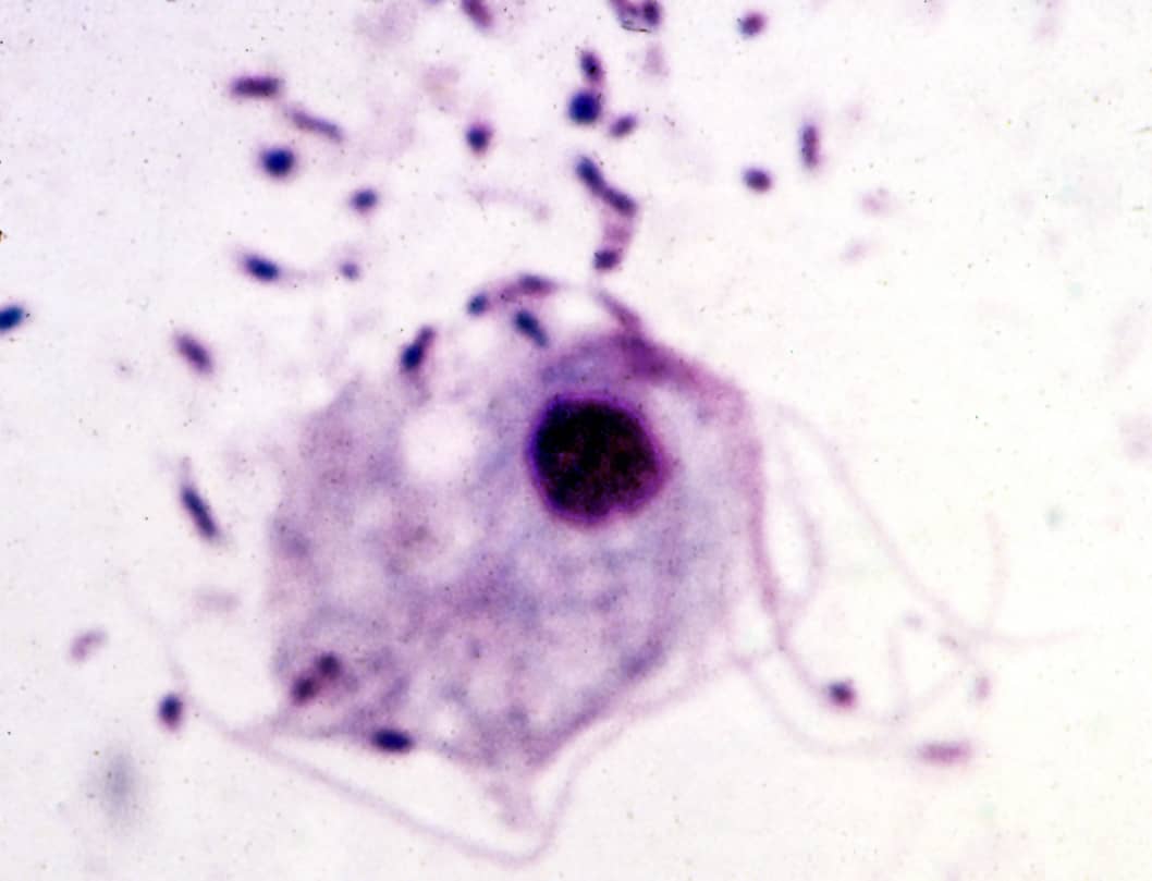 Trichomoniasis | Parasites without Borders