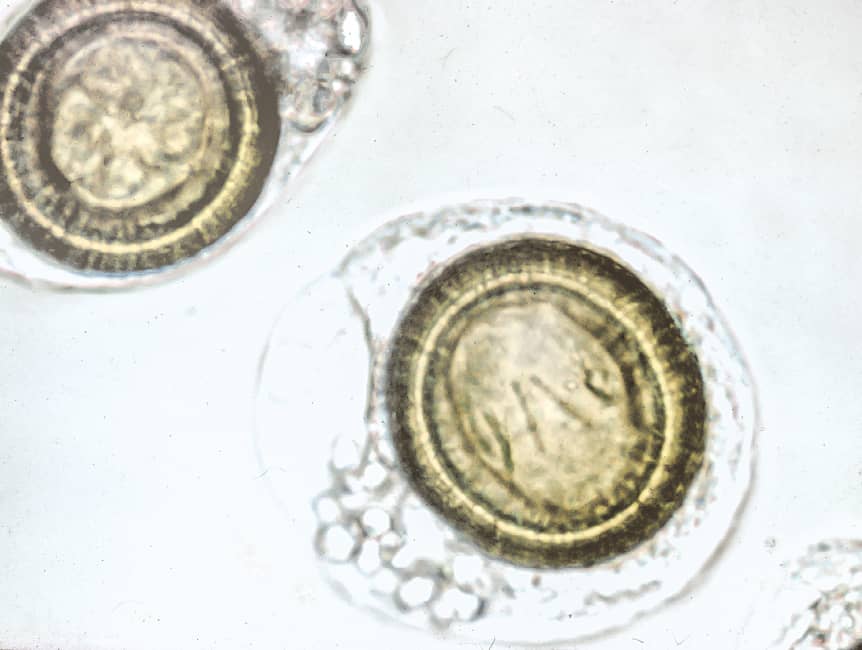 Adult cestodes (intestinal tapeworms) | Parasites without Borders