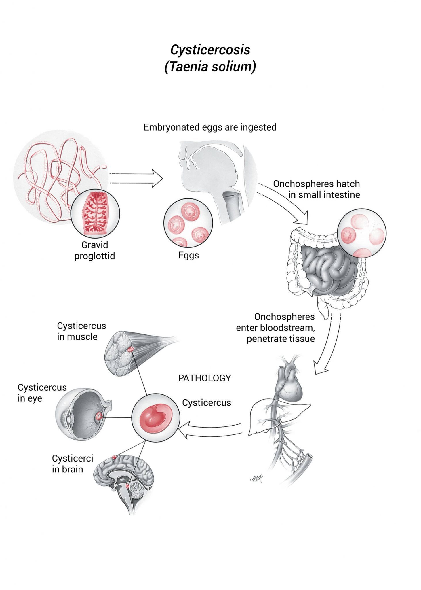 Larval cestodes (cysticercosis) | Parasites without Borders
